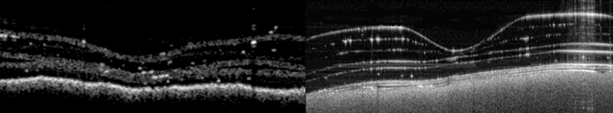 Siloton obtains ground-breaking OCT image with its Akepa photonic chip ...